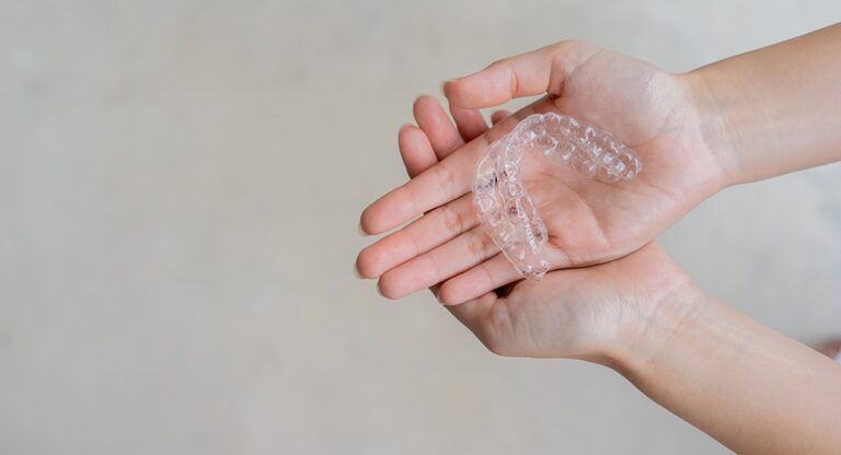 Do I Need A Retainer After Wearing Braces or Invisalign?